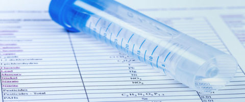 Water Quality Test | Kals Inspection Services